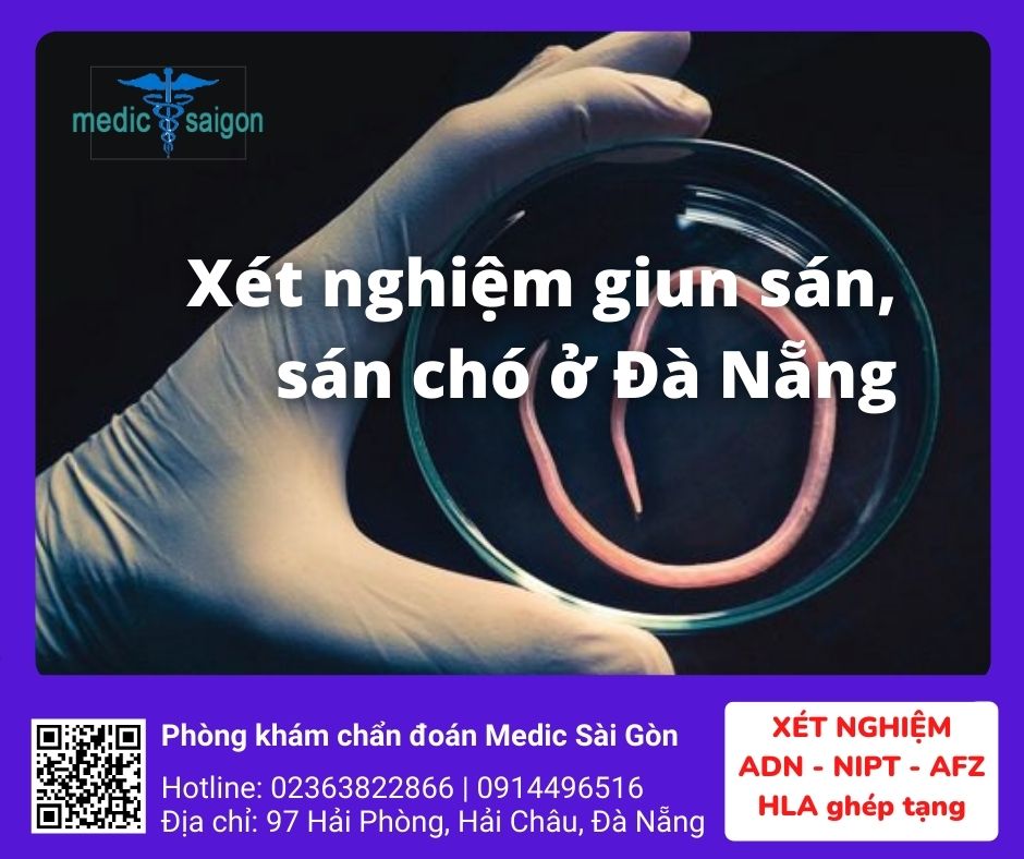 Xét nghiệm giun sán, sán chó ở Đà Nẵng - Phòng khám Medic