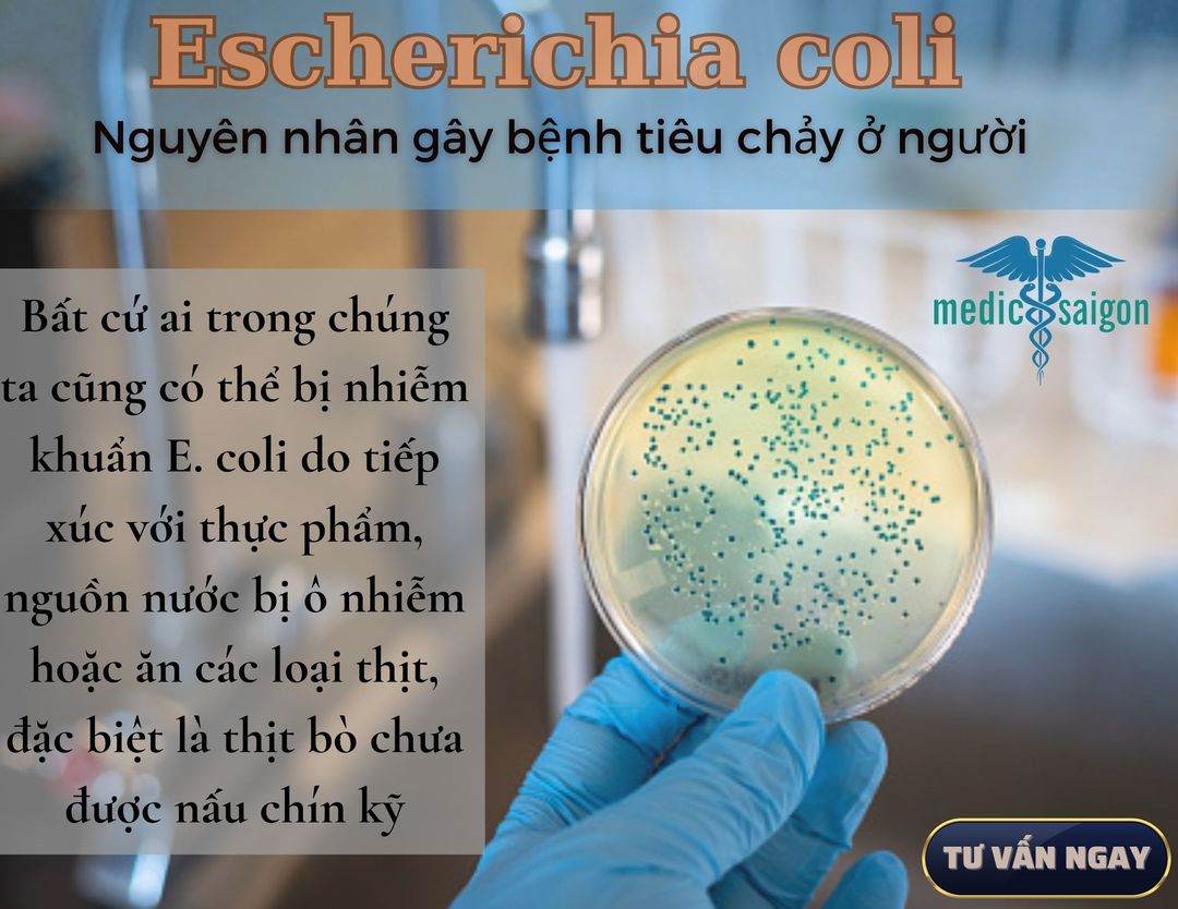 Vi khuẩn E. Coli là triệu chứng thường gặp khi bị nhiễm vi khuẩn