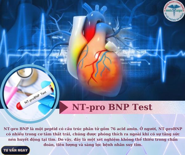 xét nghiệm NT-pro BNP sàng lọc, tiên lượng bệnh nhân suy tim